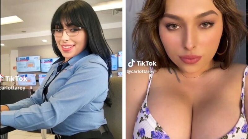 Mujer Deja Su Trabajo De Vendedora Y Se Somete A Cirugías Para Abrir Su