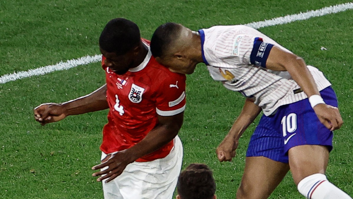 Kylian Mbappé se fractura la nariz, así fue el momento del accidente ...