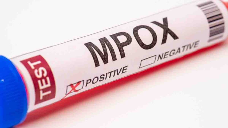 ¿Cómo se transmite la Mpox y cuáles son los síntomas más comunes? - UnoTV