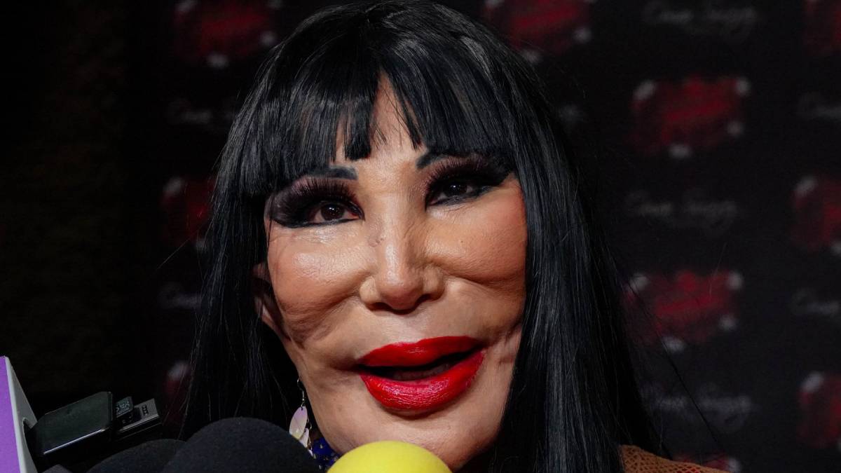 Lyn May sorprende al mundo: su cara causa impacto internacional- UnoTV Lyn May sorprende al mundo: su cara causa impacto internacional- UnoTV