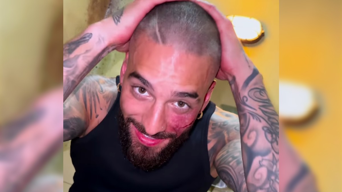 Maluma sorprende con un look rapado y rostro golpeado - UnoTV
