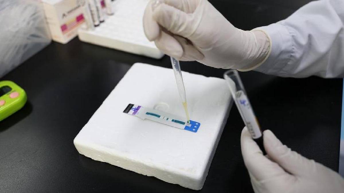 PEP: Una herramienta clave para frenar el VIH en China - UnoTV