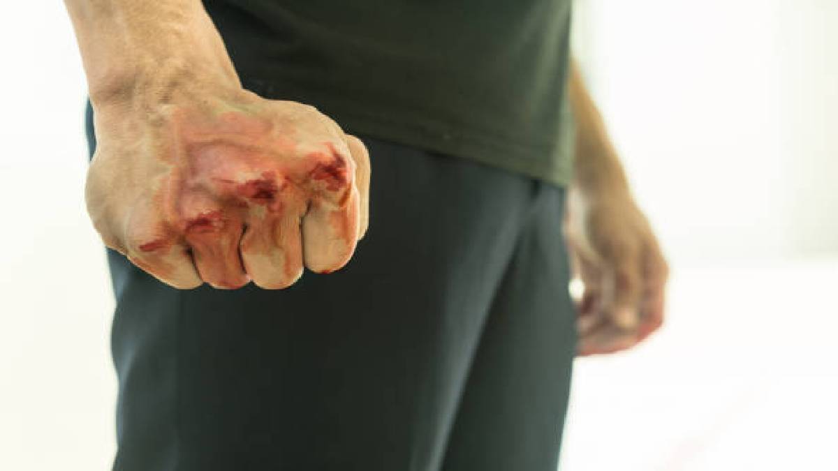 ¿Qué pasó? Golpean a integrantes de Sonido Cóndor en Miguel Hidalgo ...