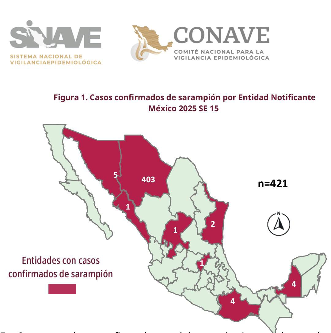Sarampión se triplica y sigue al alza, ahora se expande en el país - UnoTV