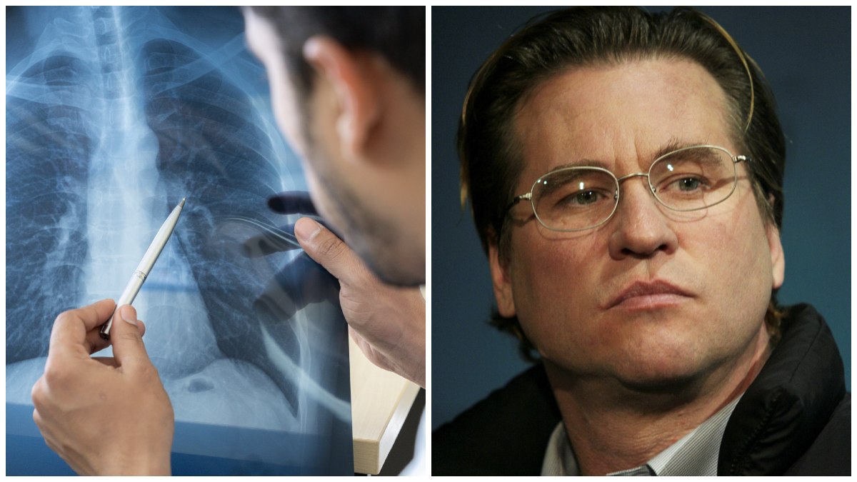 Neumonía: ¿qué es y cuáles son las señales de alerta de la enfermedad que causó la muerte de Val ...