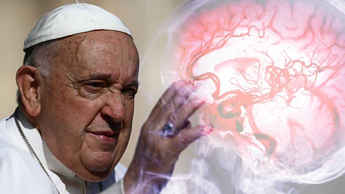 Síntomas de un derrame cerebral: la causa por la que falleció el Papa Francisco - UnoTV