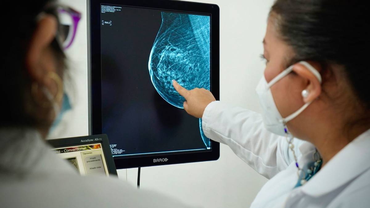 IMSS realiza su primera cirugía de reconstrucción de mama en León - UnoTV